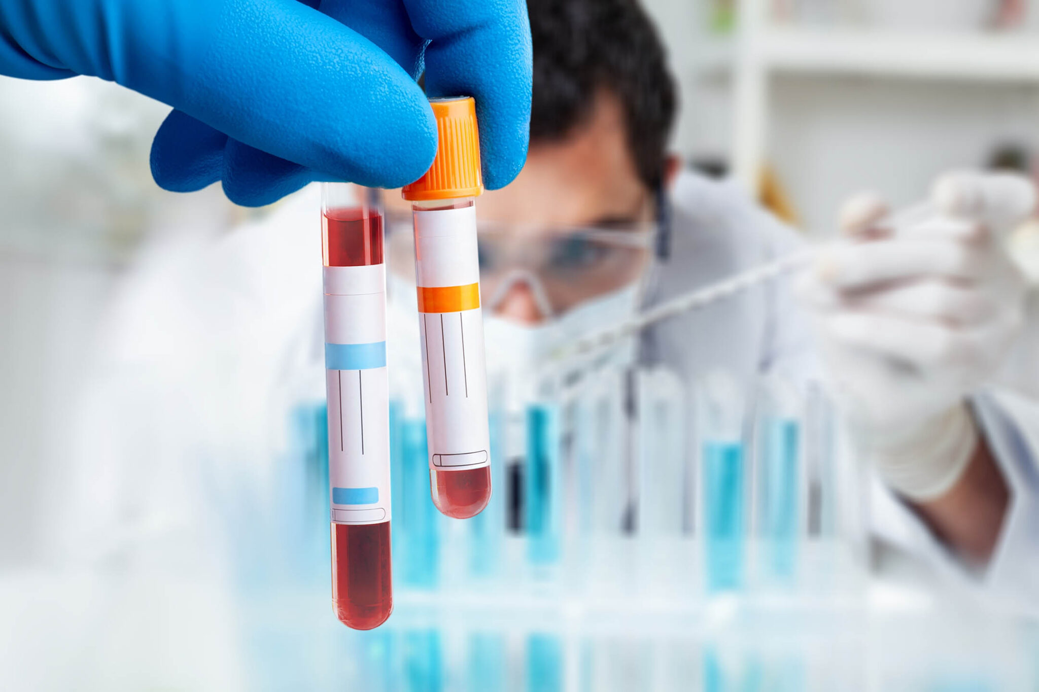 ESR Blood Test In Reading - Inflammation & Autoimmune Screening