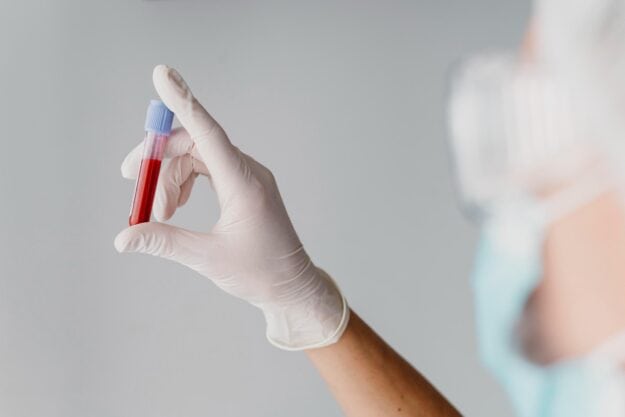 Private Blood Tests In Reading, Berkshire | Book Today | Forbury Clinic
