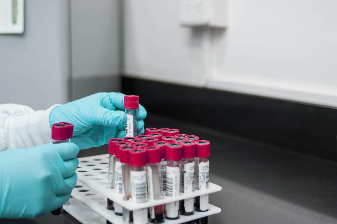 The Most Common Blood Tests And What They Detect