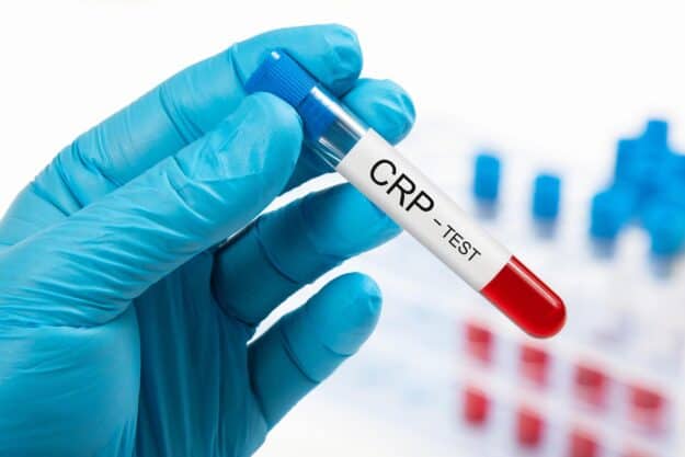 CRP Blood Test: What It Is, Normal Range & High Levels Explained