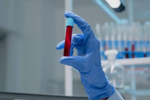 Understanding Your Blood Test Results: A Simple Guide For UK Patients